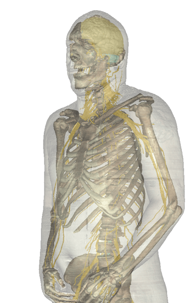 Visible Human teaches anatomy