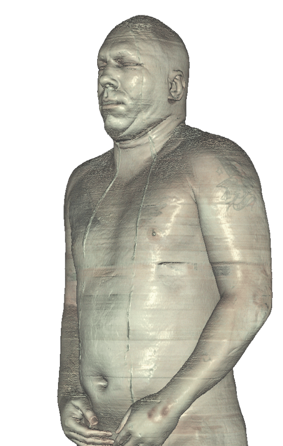 Visible Human teaches anatomy