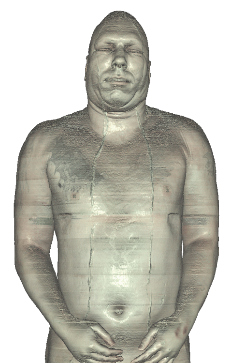 Visible Human teaches anatomy