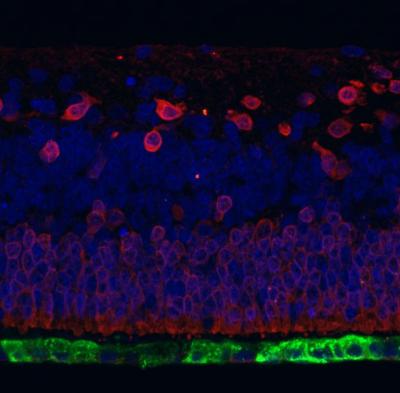 CellSight Teams Clinch Top Two of Three Awards in National Eye ...